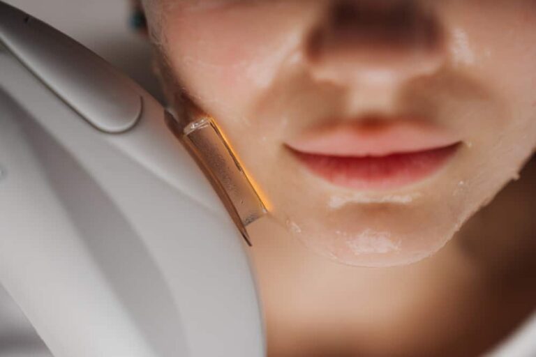 IPL Photofacial in Gilbert & Chandler | Giovanni Med Spa